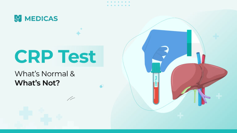 PT INR Normal Range: Understanding Prothrombin Time & INR